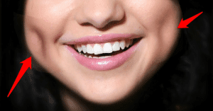 This Is What It Really Means If You Have Dimples In Your Cheeks - The ...